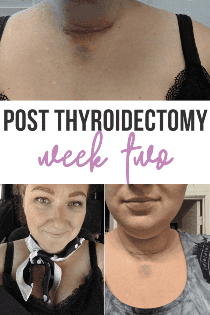 Thyroidectomy Recovery (Week 2) – Sadie Smiley
