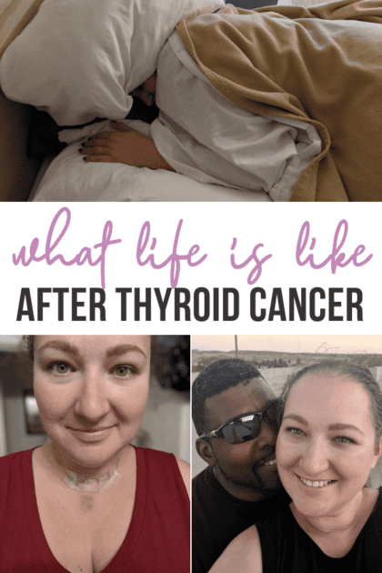Thyroidectomy Scar Healing Tips – Sadie Smiley